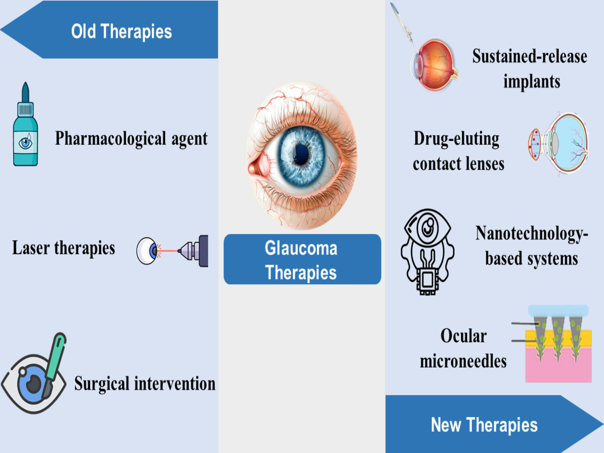 Current and Emerging Therapies for Glaucoma: A Narrative Review ...